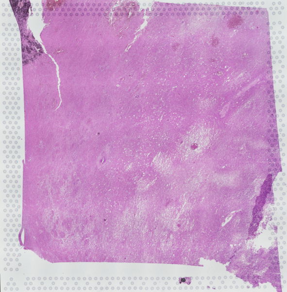 gbmvisium.snu.ac.kr - /spacerangerout/SNU16A/spatial/