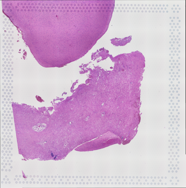 gbmvisium.snu.ac.kr - /spacerangerout/SNU25A/spatial/